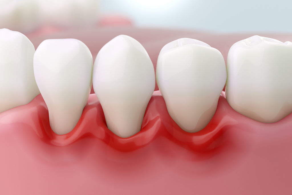 Understanding Gum Pain: Causes, Relief, and Treatment